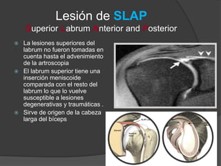 Inestabilidad del hombro y lesiones de labrum | PPTX
