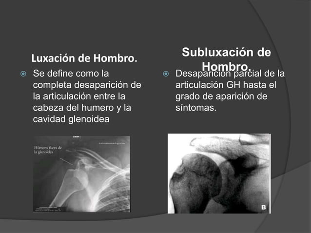 Lesión Del Labrum De Hombro: Síntomas, Diagnóstico Y Tratamiento – CEVFQ