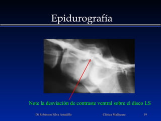 Inestabilidad Lumbosacral | PPT