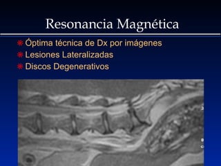 Inestabilidad Lumbosacral | PPT