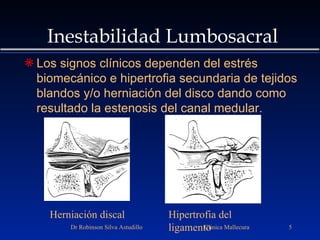 Inestabilidad Lumbosacral | PPT