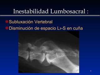 Inestabilidad Lumbosacral | PPT