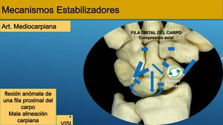 Inestabilidad Del Carpo Dr. Jose Brizuela | PPTX
