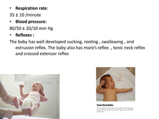 INFANCY.pptx