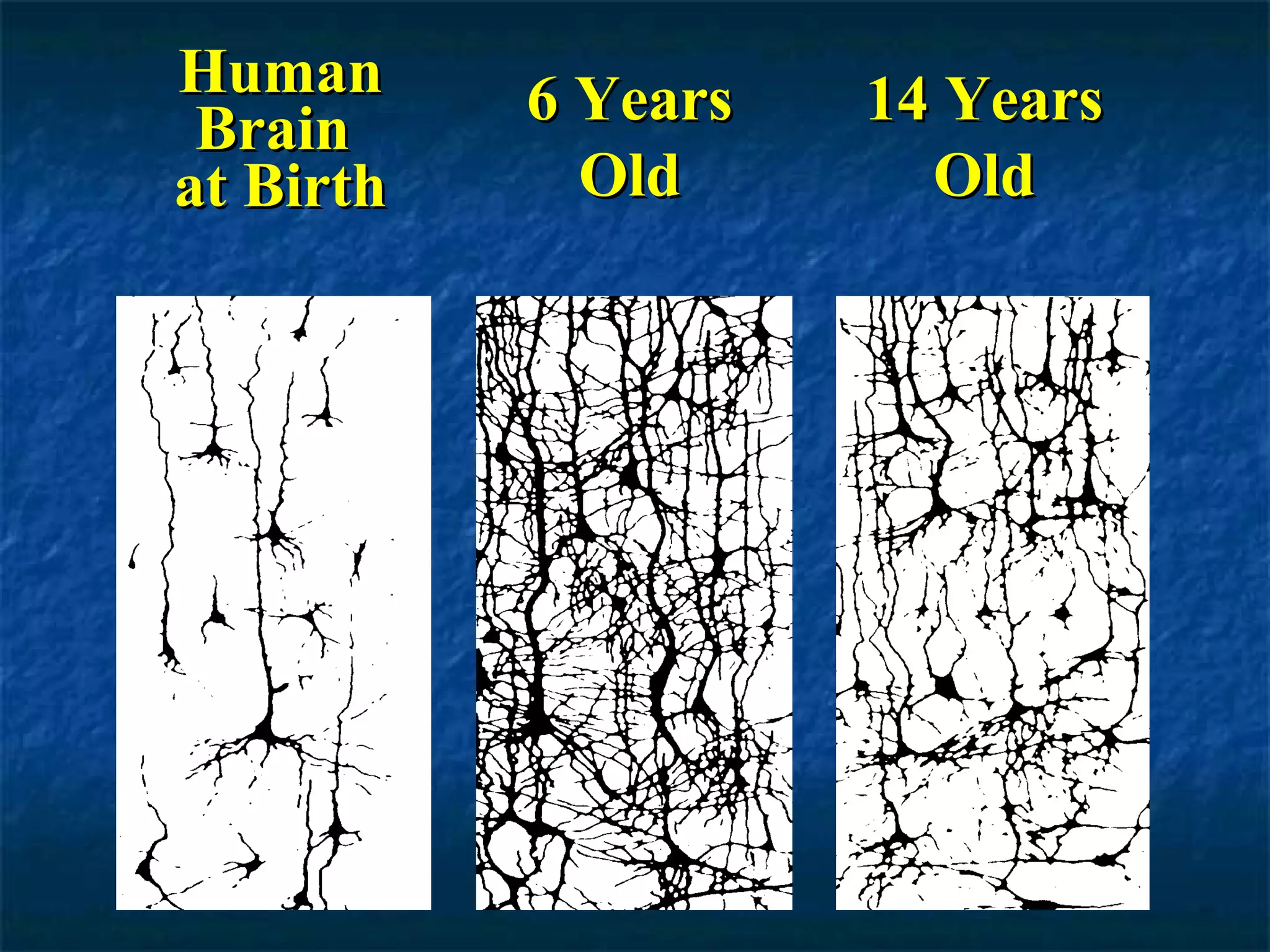 Infant brain development | PPT