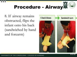 How to do infant resuscitation and what is the proper | PPT