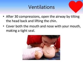 Infant CPR | PPTX
