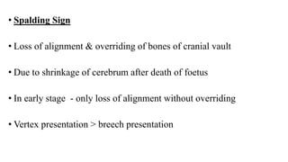 Infant death 1 | PPTX