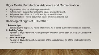 Infant deaths fmt powerpoint presentation. | PPTX