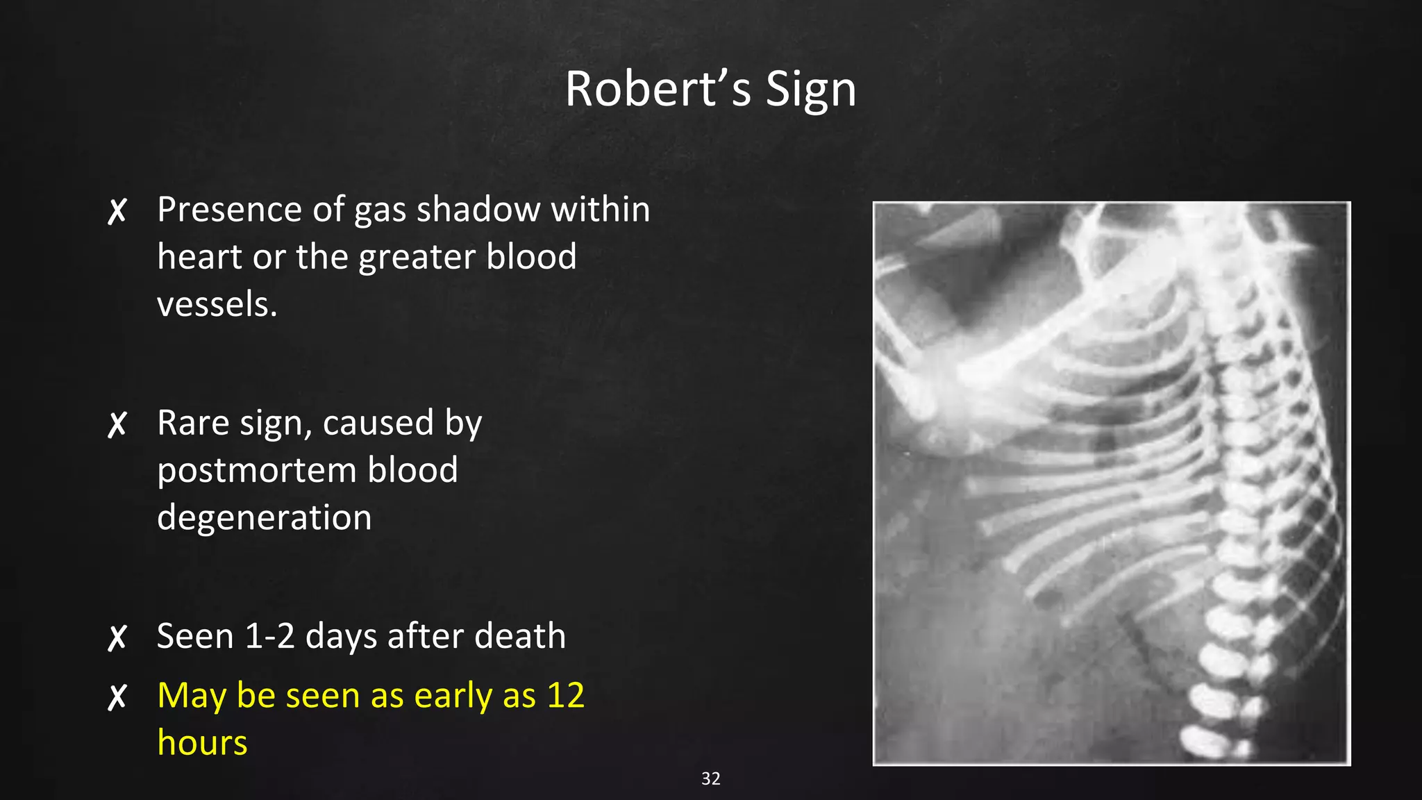 Infanticide -converted.pdf