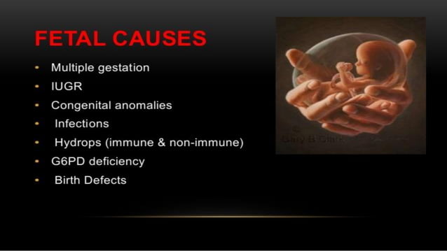 Infanticide -converted.pdf