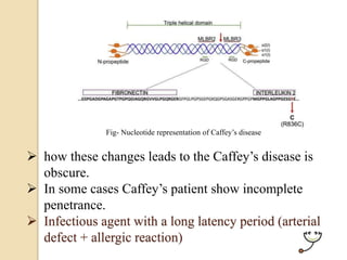 Infantile cortical hyperostosis dr. rohit kumar singh | PPTX