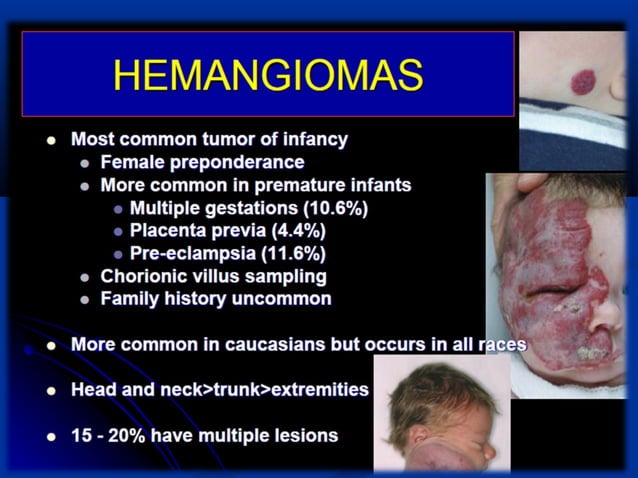 Infantile hemangioma | PPT | Blood Disorders | Diseases and Conditions
