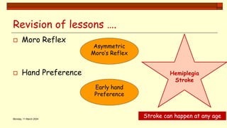 Infantile Hemiplegia & Stroke UG medicine ne.pptx