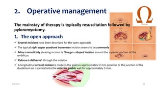 Infantile hyperthropic pyloric stenosis | PPTX