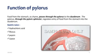 Infantile hyperthropic pyloric stenosis | PPT