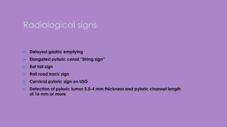 Infantile hypertrophic pyloric stenosis | PPTX