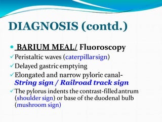 Infantile hypertrophic pyloric stenosis | PPTX