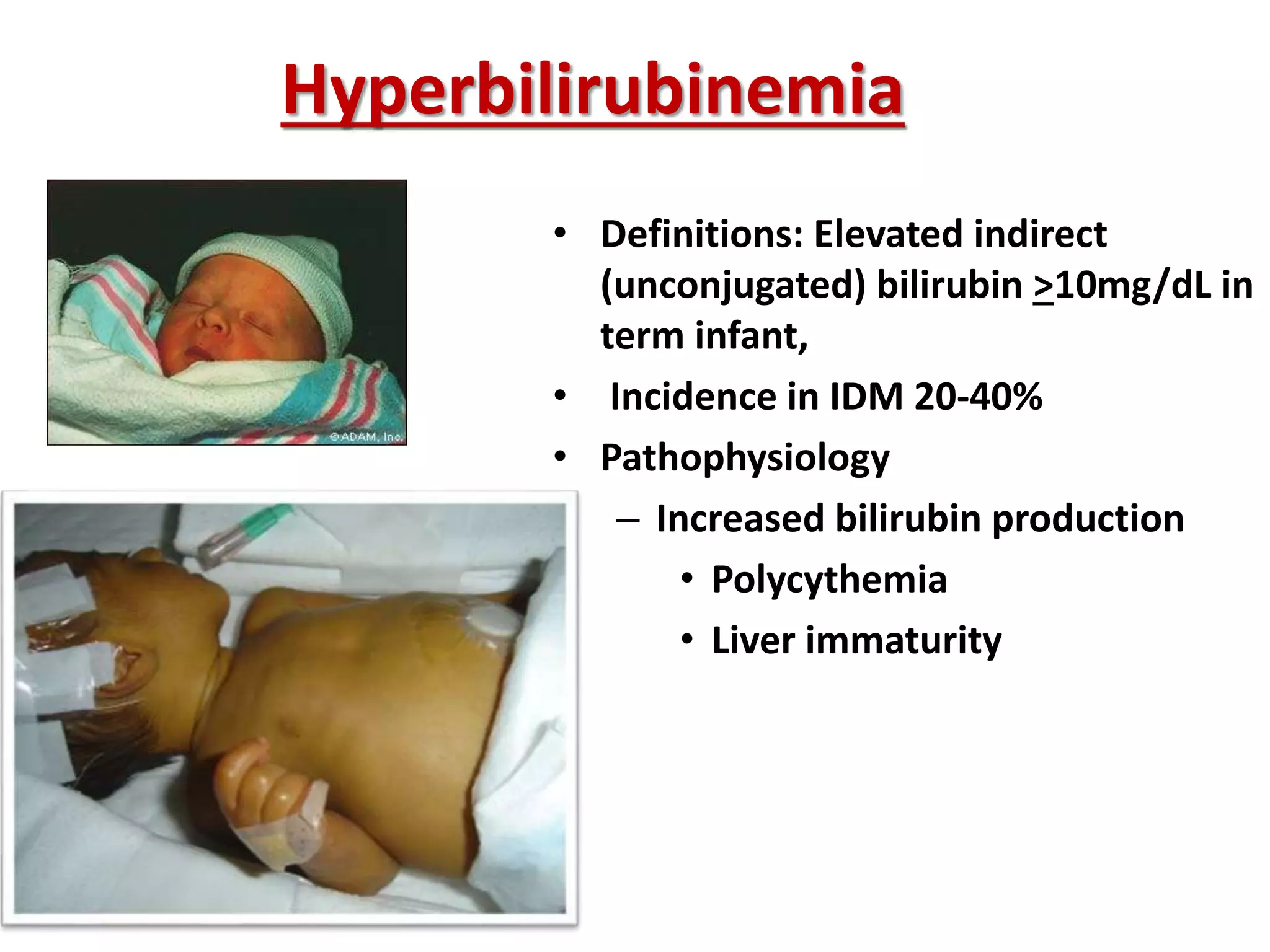 Infant of diabetic mother | PPTX