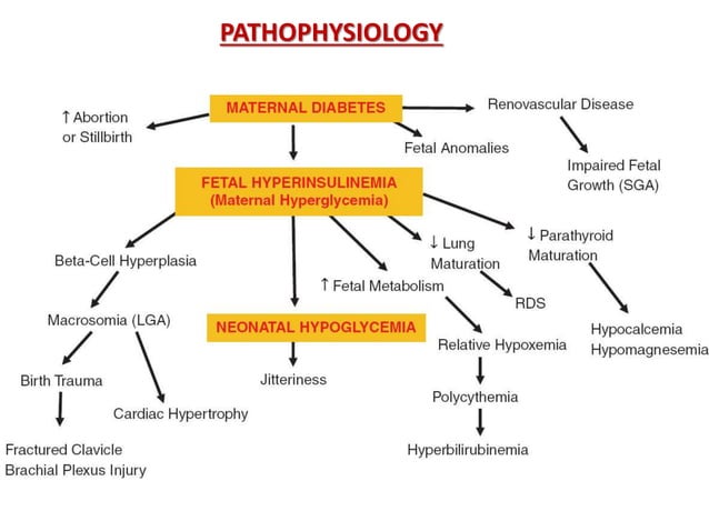 Infant of diabetic mother