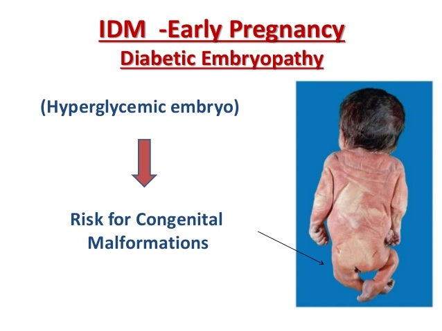 Infant of diabetic mother