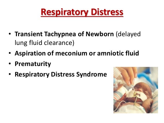 Infant of diabetic mother