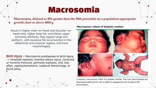 infant of diabetic mother.pptx