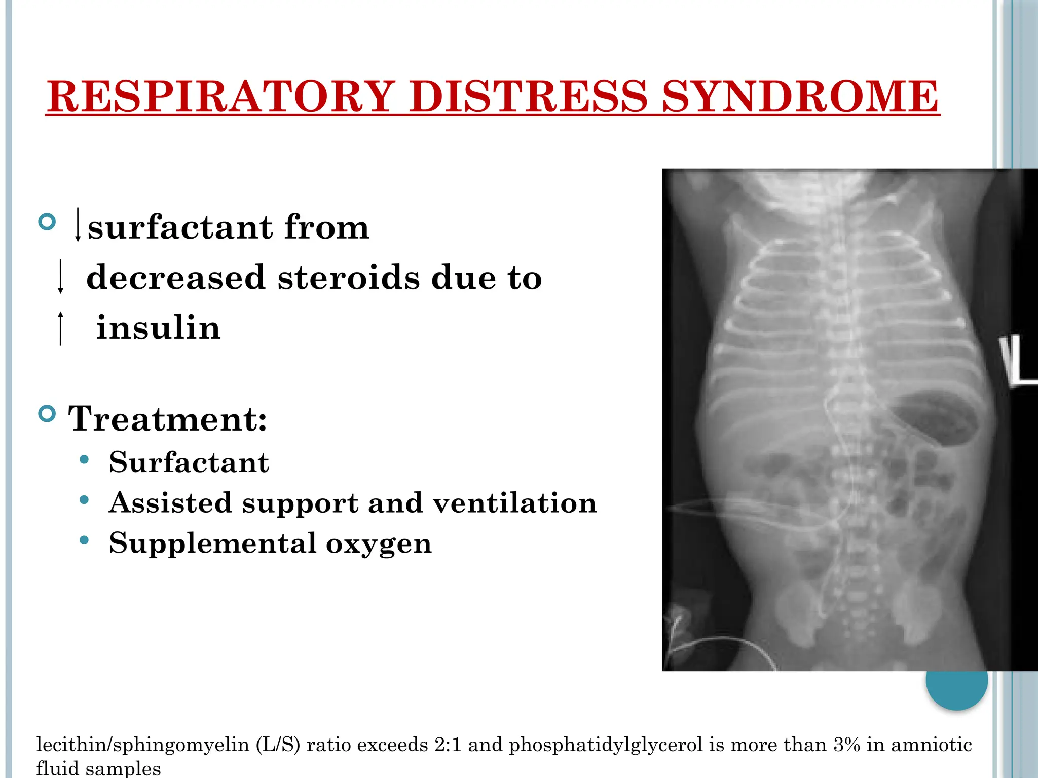 INFANT OF DIABETICgggbcbvvfdgh MOTHER.pptx