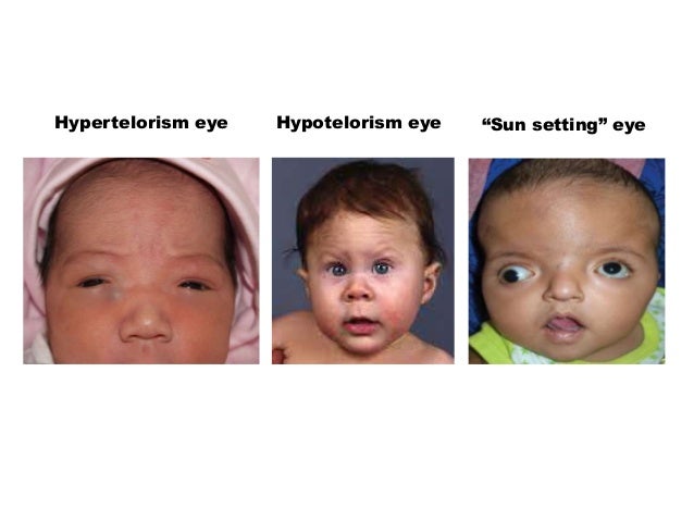 Infant Physical Assessment