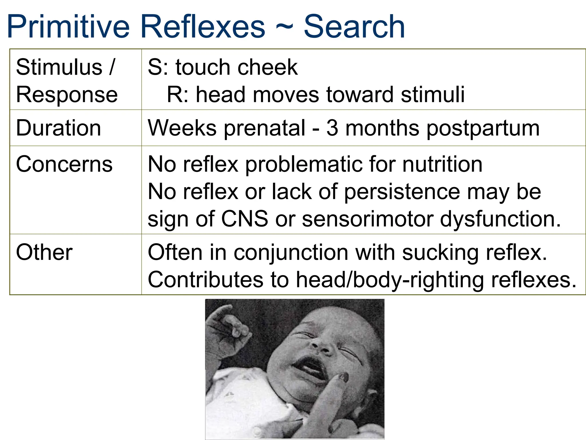 infant reflexes.ppt neuro rehabilitation | PPT