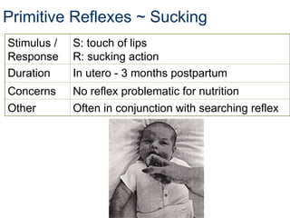 infant reflexes.ppt neuro rehabilitation | PPT