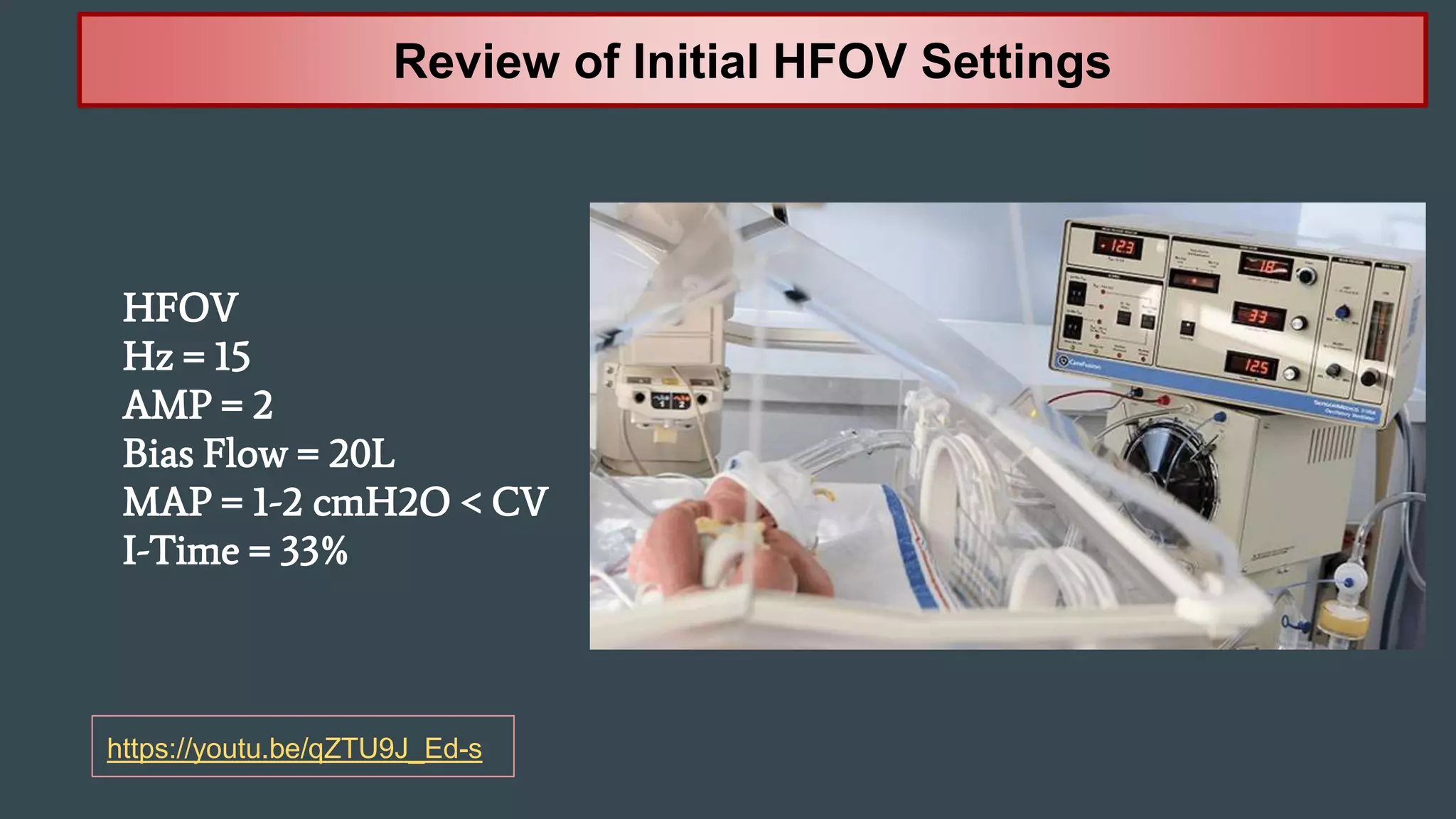 Infant respiratory distress syndrome PPV guideline