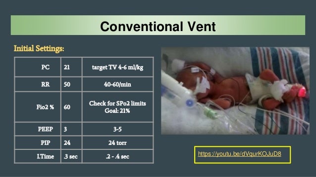 Infant respiratory distress syndrome PPV guideline
