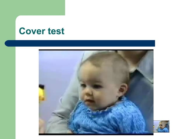 Infant's vision | PPT