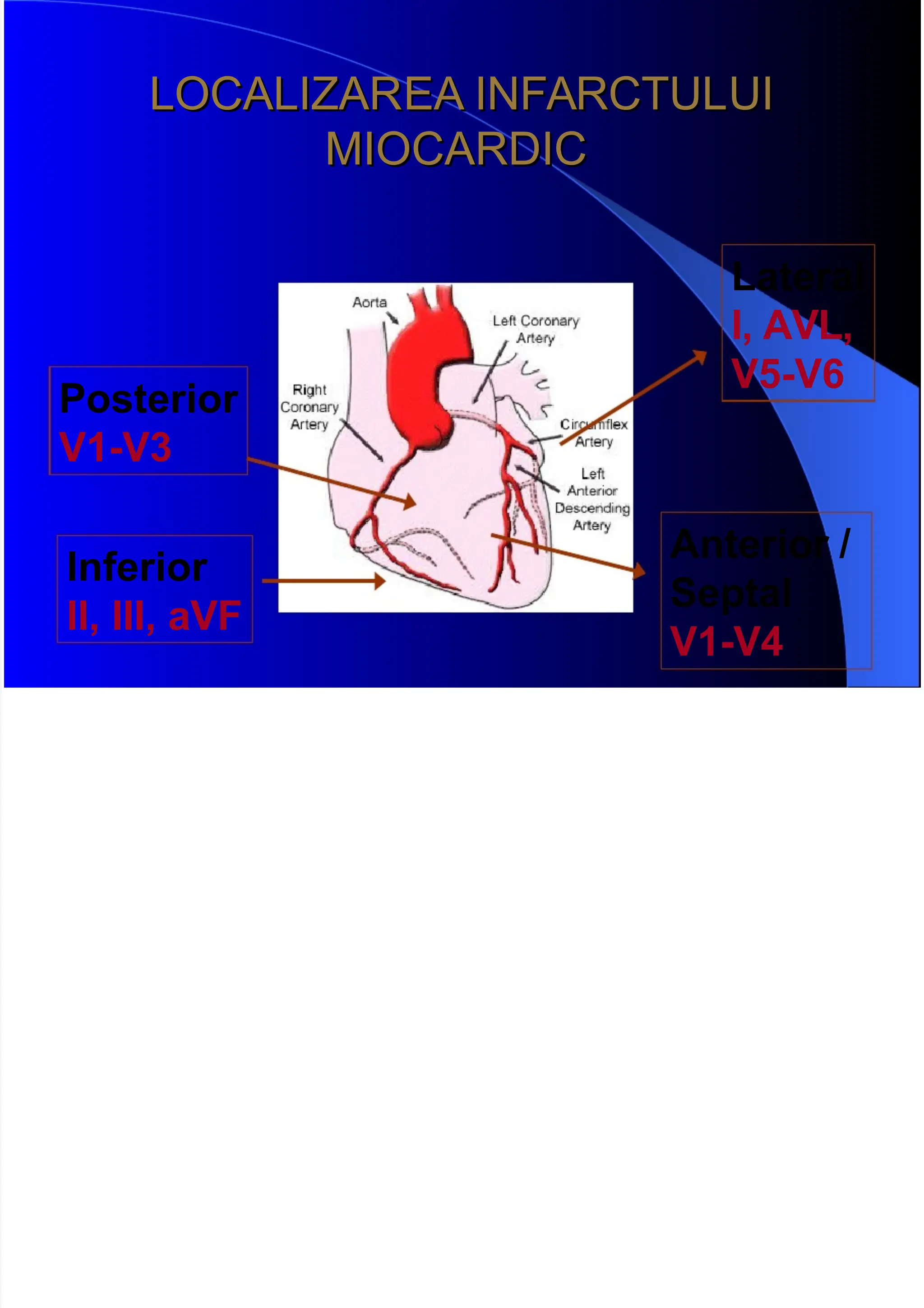 infarct-miocardic-acut.pdf prezentare cu imagini | PDF