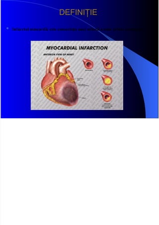 infarct-miocardic-acut.pdf prezentare cu imagini | PDF