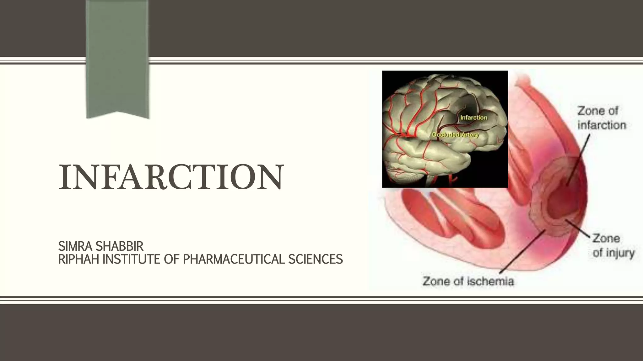 Infarction | PPTX
