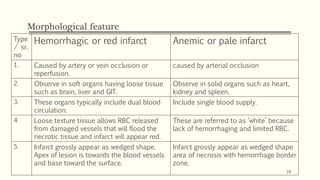 Infarction | PPTX