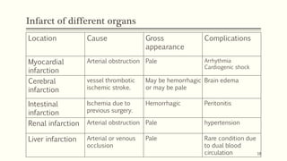 Infarction | PPTX