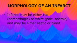 Infarction | PPTX