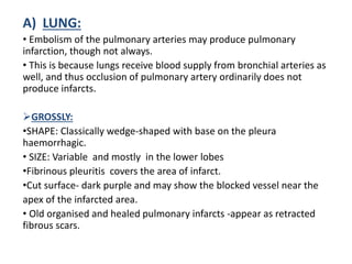 INFARCTION pathology medical students h | PPTX | Blood Disorders ...