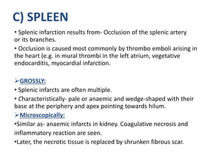 INFARCTION pathology medical students h | PPTX | Blood Disorders ...