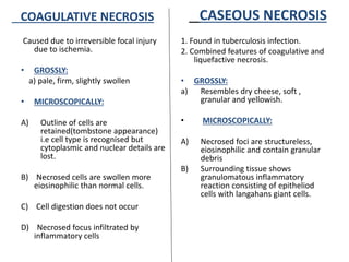 INFARCTION pathology medical students h | PPTX
