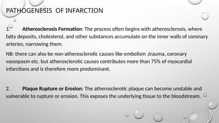 INFARCTION. . | PPTX