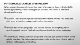 INFARCTION. . | PPTX