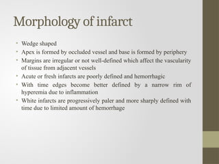 Infarction pathology lecture medical.pptx