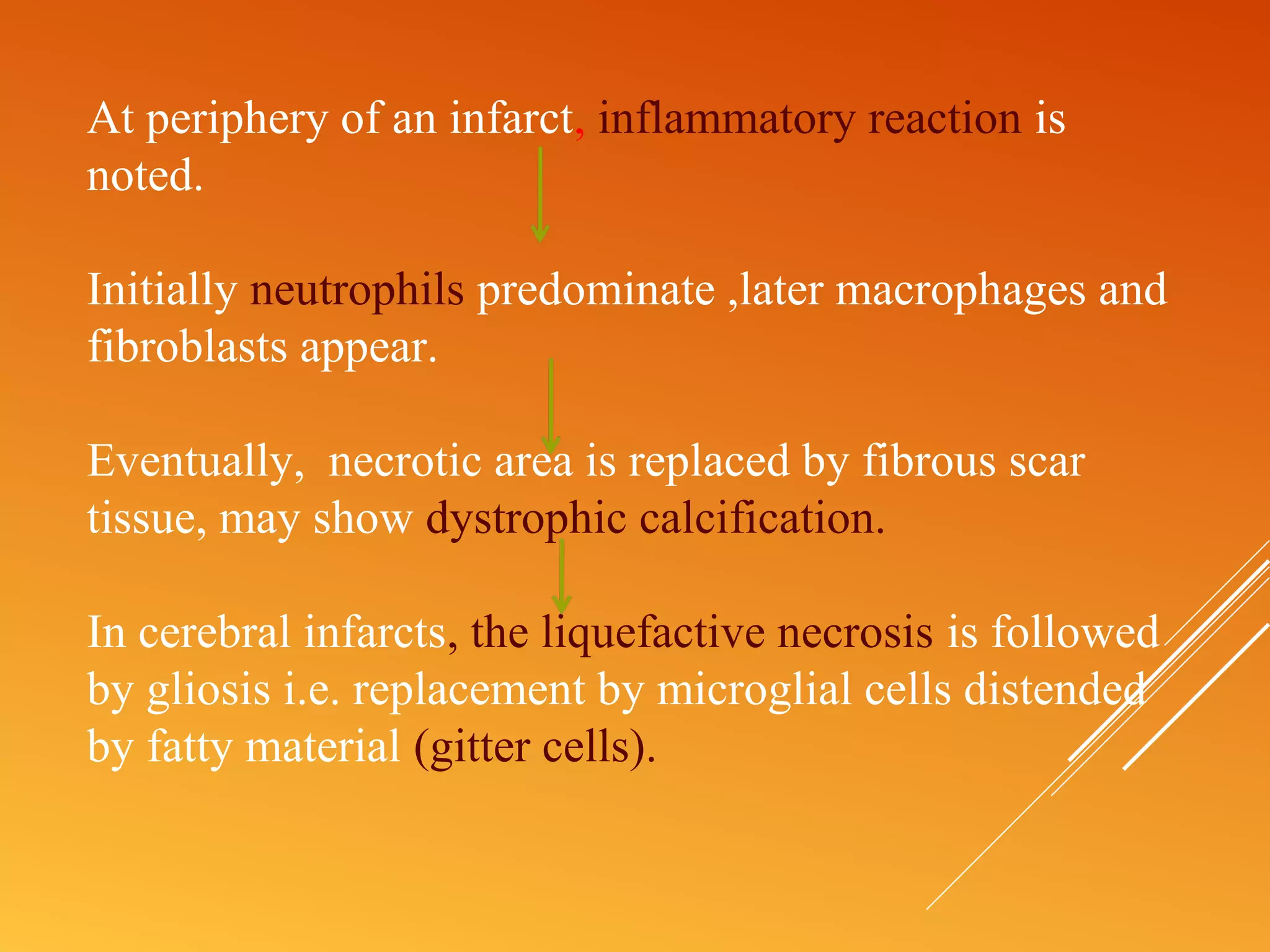 Infarction | PPT