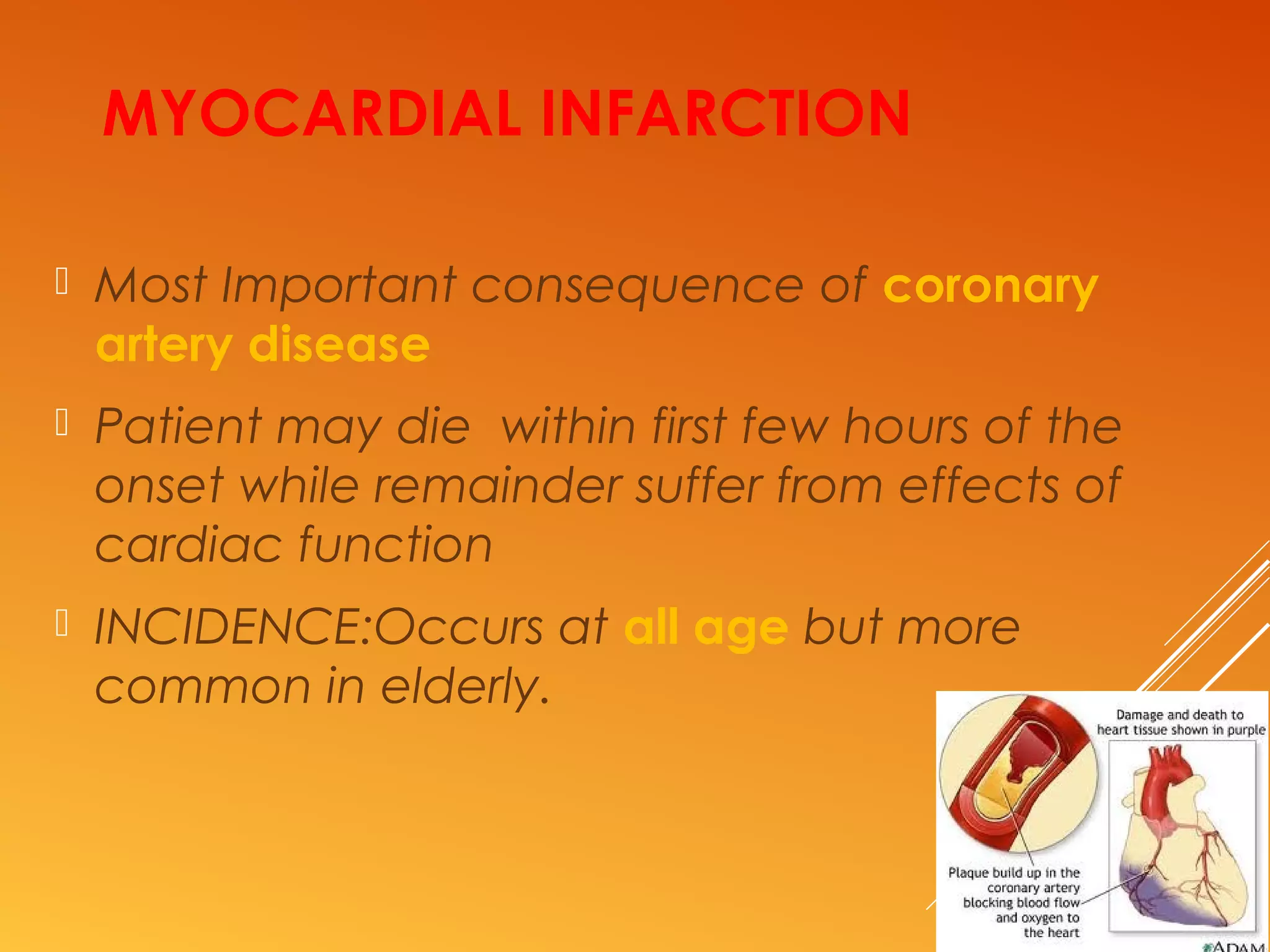 Infarction | PPT