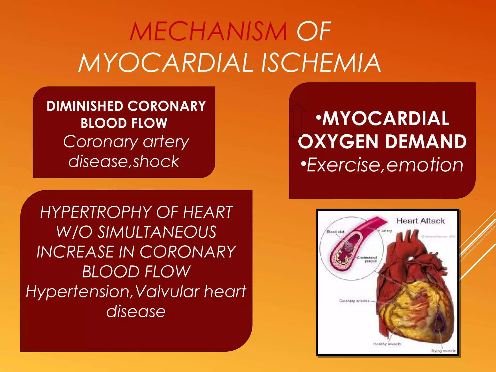 Infarction | PPT