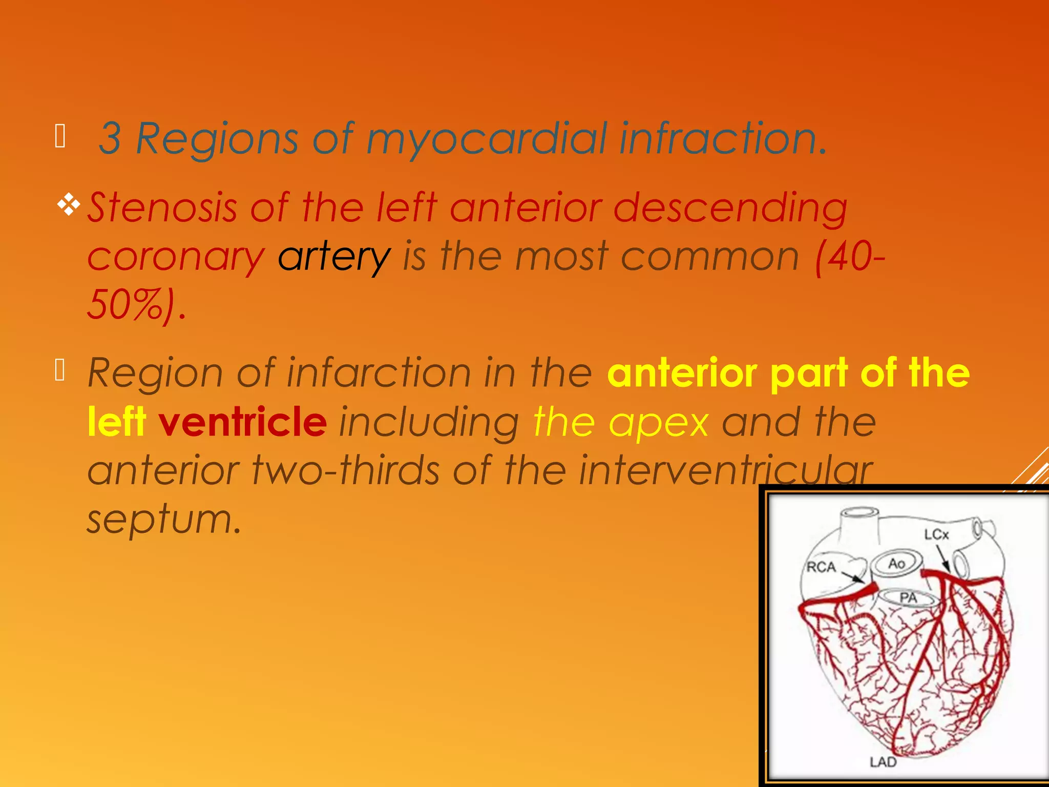 Infarction | PPT